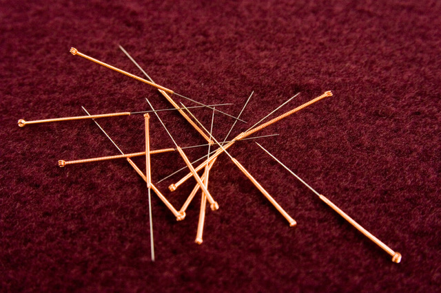 Acupuncture explained – The Integrative Medicine Center